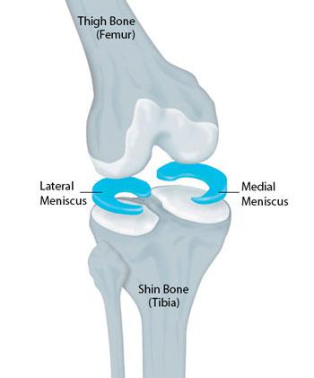 Meniscus Injuries - My Family Physio
