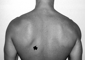 Scapula Stability - My Family Physio