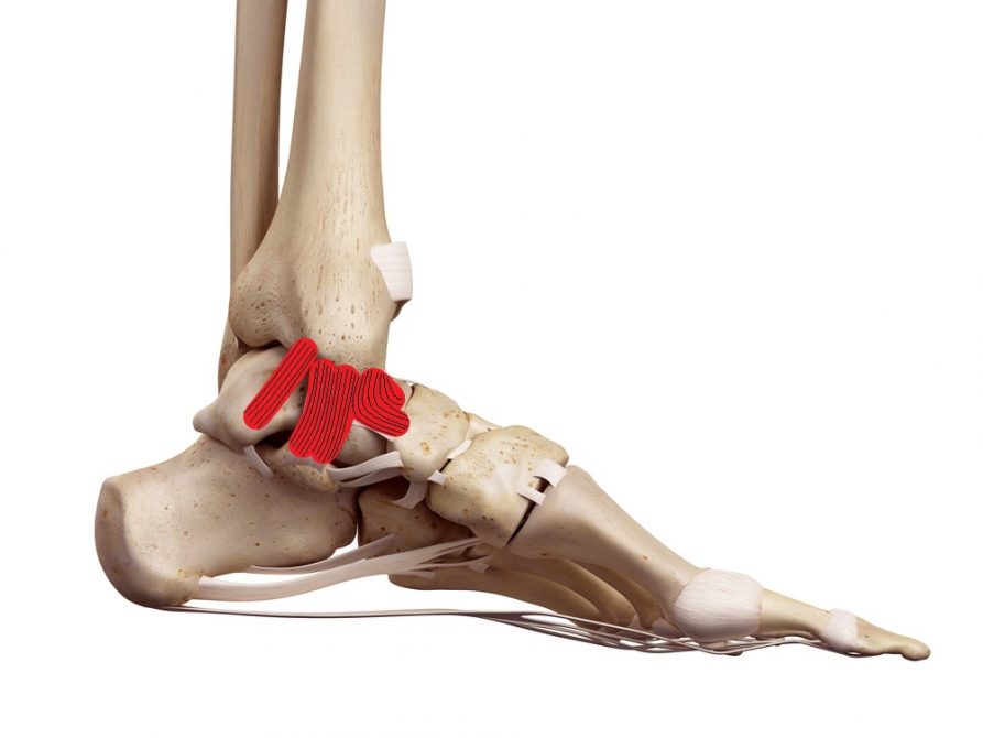Ankle Sprains - My Family Physio