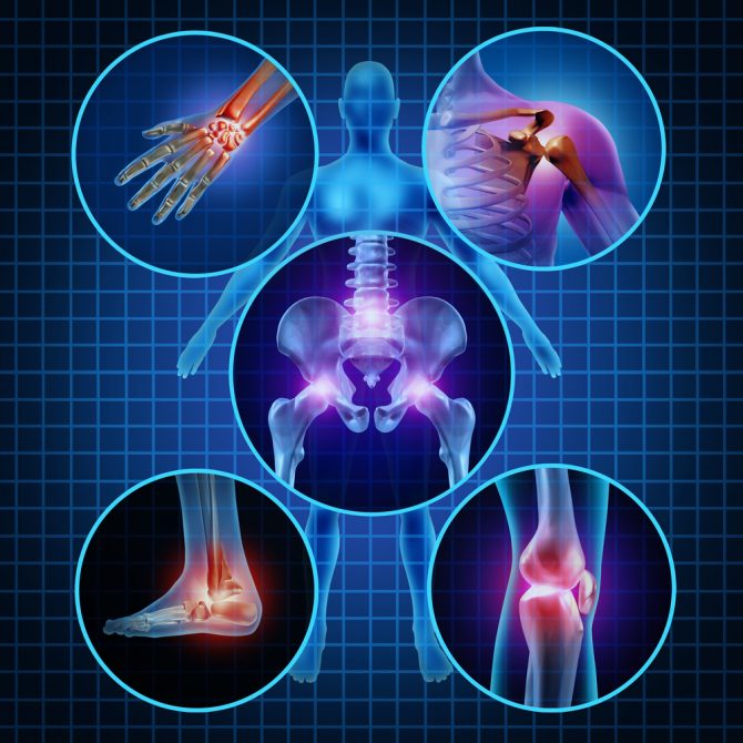 Ankylosing Spondylitis - My Family Physio