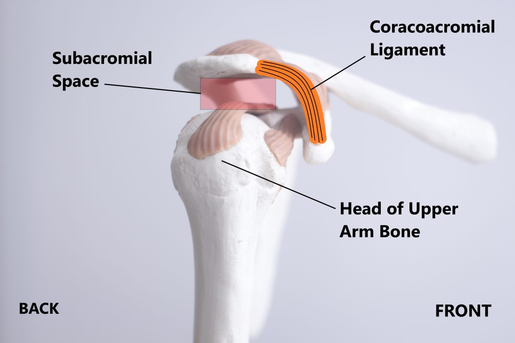 Shoulder Impingement - My Family Physio