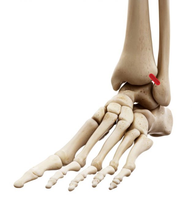 Ankle Sprains - My Family Physio