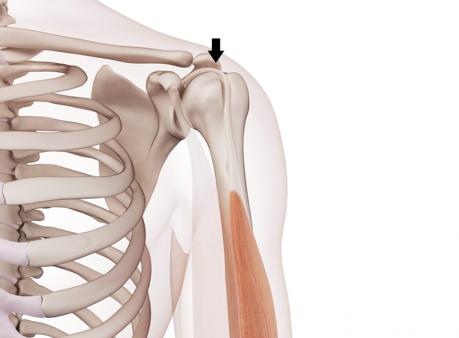 Biceps Tendon Injuries - My Family Physio