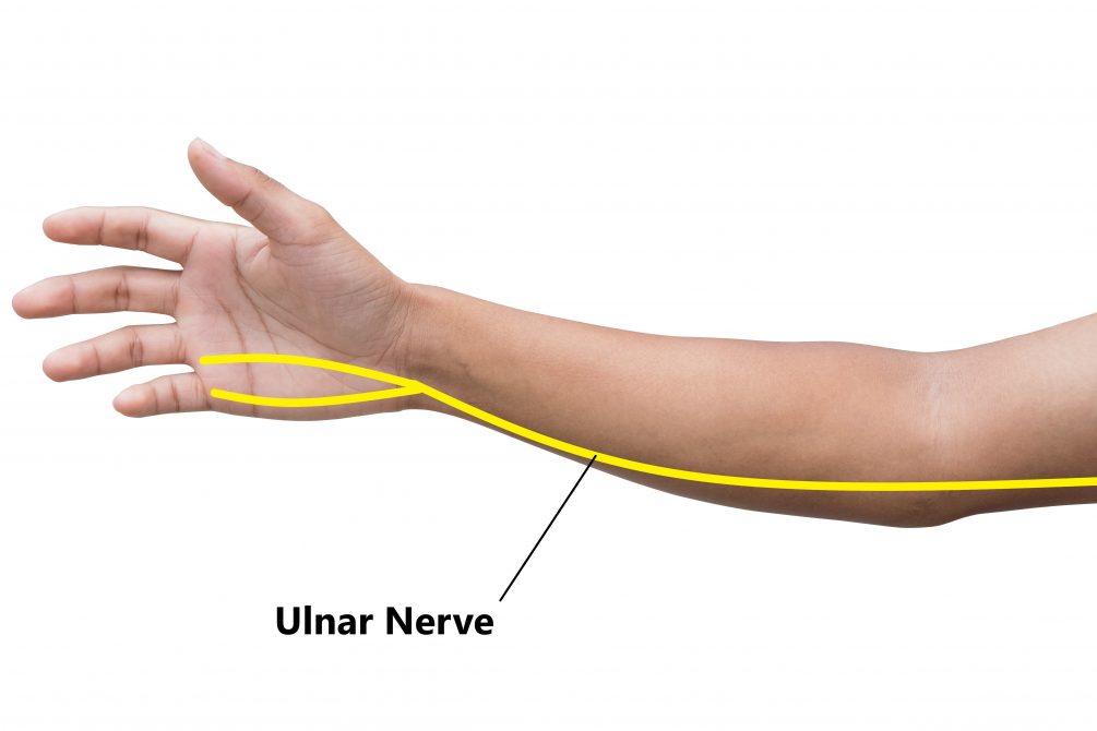 Cubital Tunnel Syndrome - My Family Physio