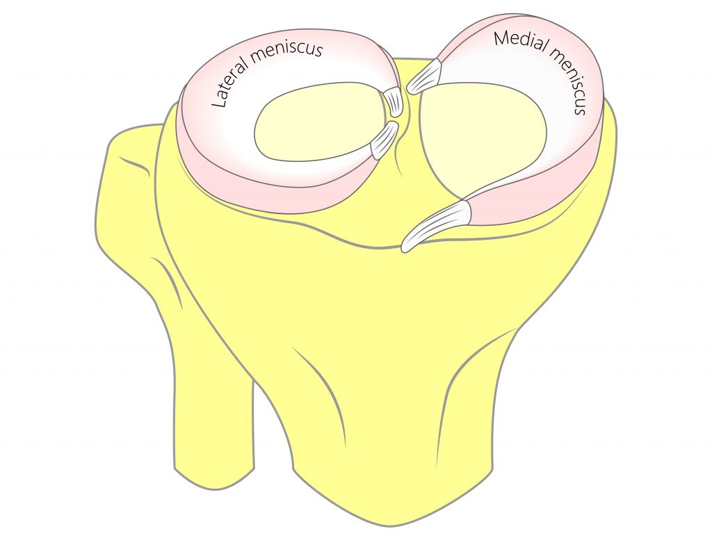 Meniscus Injuries - My Family Physio