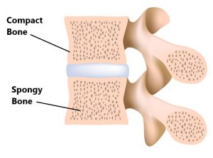 Modic Changes - My Family Physio