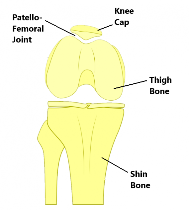Patellofemoral Pain Syndrome - My Family Physio