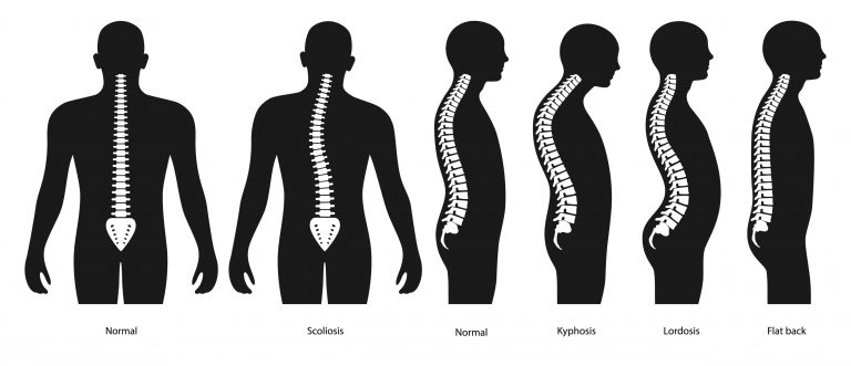 How to Improve Your Posture - My Family Physio