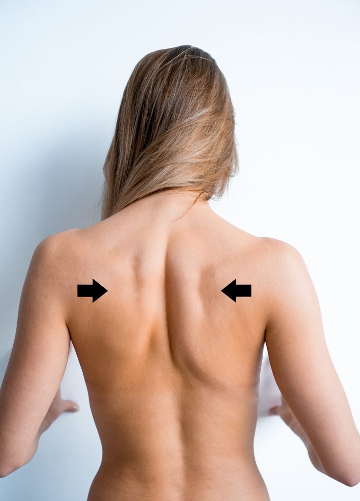 Scapula Stability My Family Physio