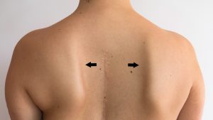 Scapula Stability - My Family Physio