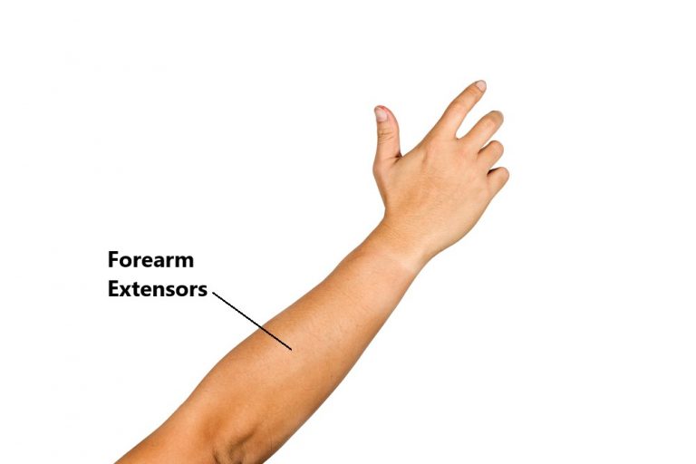 Tennis Elbow (Lateral Epicondylitis) - My Family Physio