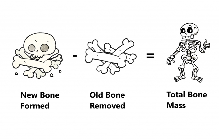Osteoporosis - My Family Physio