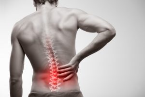 Common Lower Back Injuries - My Family Physio