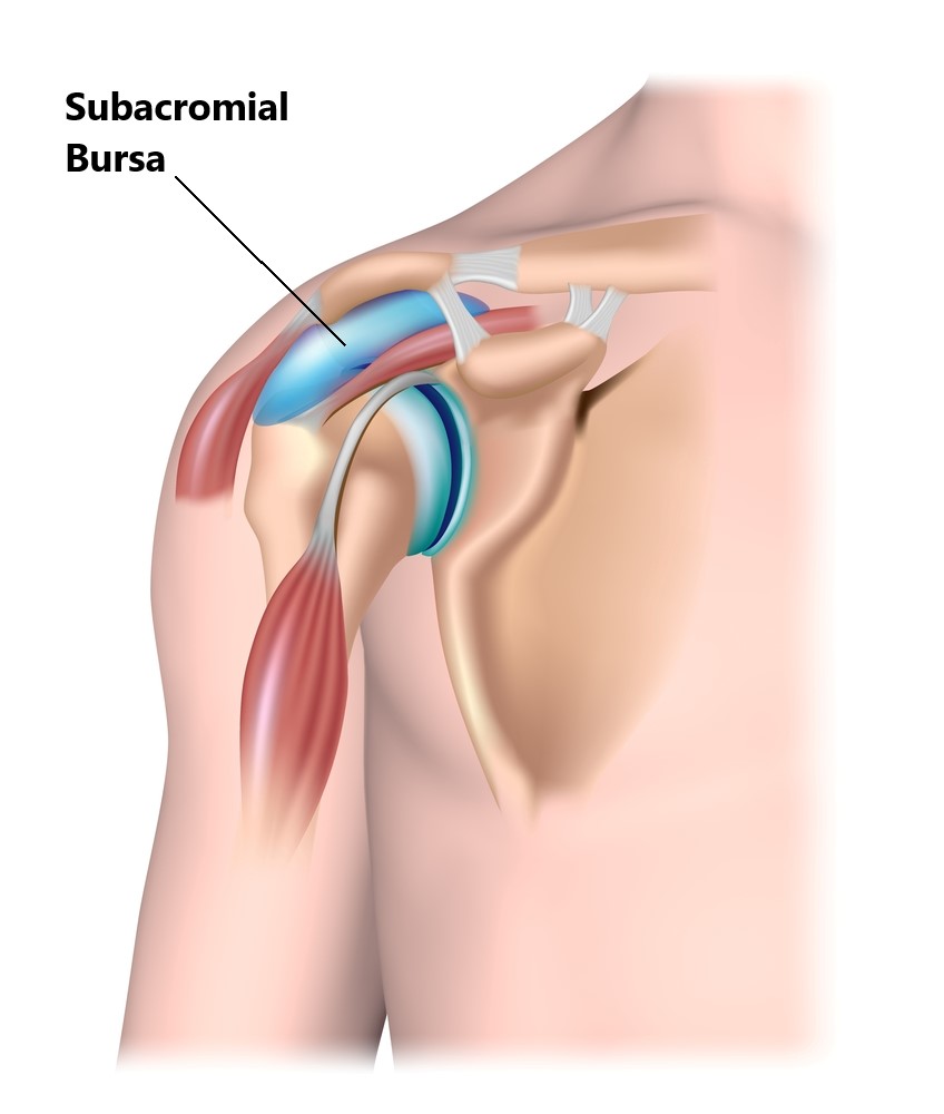 Common Shoulder Injuries My Family Physio