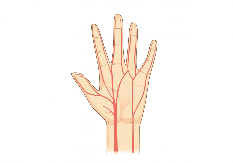 Common Thumb Injuries - My Family Physio