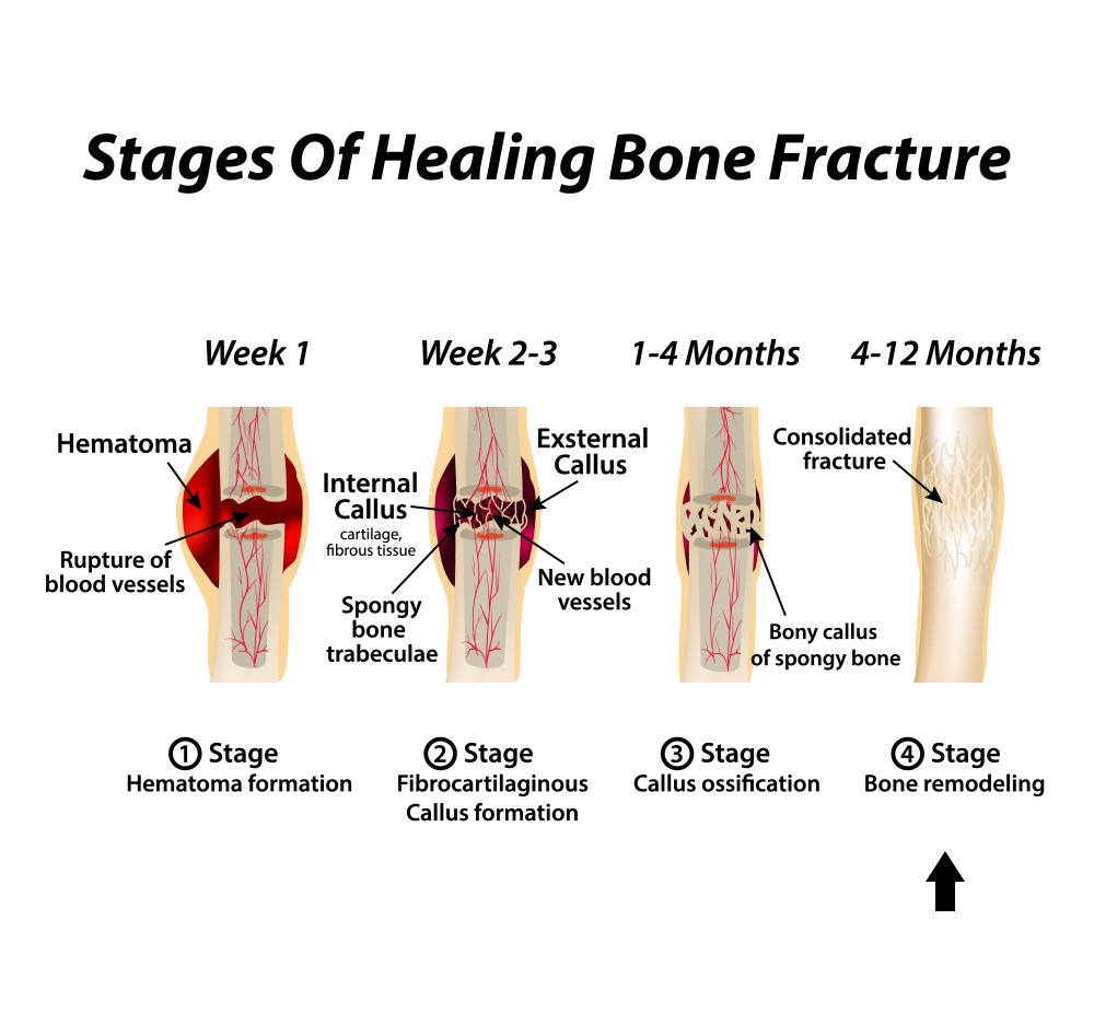 Tissue Healing My Family Physio Tissue Healing My Family Physio